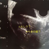 14w5dのエコーです！ - 先生がくれたエコーがわからない... - Yahoo!知恵袋