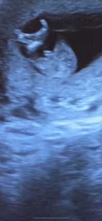 13w1dで検診に行きましたがこれは男の子でしょうか？このよ... - Yahoo!知恵袋