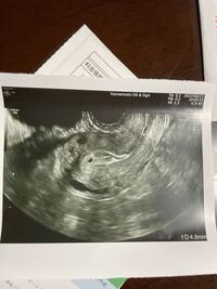 妊娠検査薬で陽性が出て今朝5w3dで病院へ行きました。 - ... - Yahoo!知恵袋