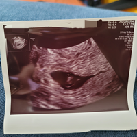 妊娠9w4dです。本日、3回目の検診に行ってきました。不安な... - Yahoo!知恵袋