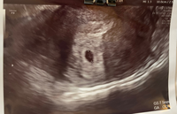 先月、体外受精をして本日bt19です。週数は5w3d通院して... - Yahoo!知恵袋