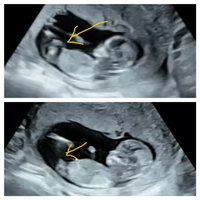 こんばんは！13w1dです。主人が、これ男の子のマークじゃない？と言い... - Yahoo!知恵袋