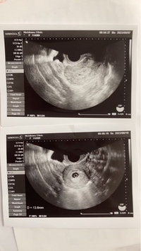 本日7w0dで病院に行ったのですが、診察の際先生がうーーんと... - Yahoo!知恵袋