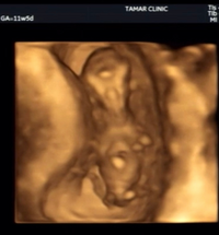 現在12週の妊婦です。11w5dの際に初めて4Dエコーをして頂いたので... - Yahoo!知恵袋