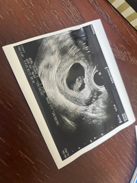 現在9w4dで初めての妊娠です。検診をしてもらっているクリニ... - Yahoo!知恵袋