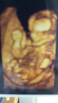 13w4dの検診で男の子確定！とゆわれました。先生はかなり自... - Yahoo!知恵袋