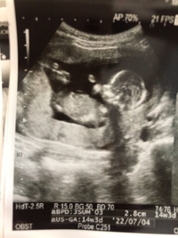 現在14w5dの妊婦です。2日前に健診に行ってきたのですが、このエコー写... - Yahoo!知恵袋