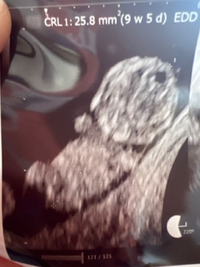 見方がよく分かりません。現在9w5dです。CRL1:25.8m... - Yahoo!知恵袋