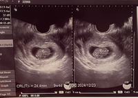 現在9w4dの妊婦です。先程いただいたエコー写真ですが、赤ちゃんの大きさ... - Yahoo!知恵袋