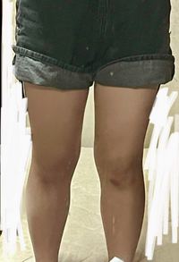 身長157、体重51kgです。太ももが50cm、ふくらはぎが3... - Yahoo!知恵袋