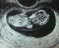 11w5dです。NTについてです。 - いつもお世話になってます(>_