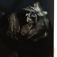 14w5dの時のエコーなのですが、赤ちゃんの大きさ測る所に、バッ... - Yahoo!知恵袋