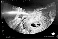 エコー写真でます本日受診し、今日で6週5日かな？と言われました。... - Yahoo!知恵袋