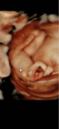 教えてください！現在妊娠して13w1dになります。妊婦健診に行ってきて4D... - Yahoo!知恵袋
