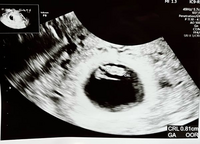 推定7w0dです。先週推定6w0dの日に初診へ行き、胎芽4.3m... - Yahoo!知恵袋