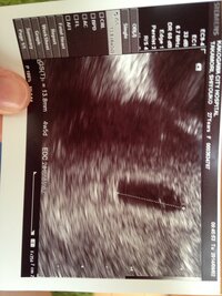 胎嚢と卵黄嚢について。現在、妊娠5w3dで受診してきました。胎嚢が... - Yahoo!知恵袋