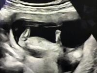 ただ今13w1dの妊婦です。 - 性別がわかるのはまだ先の事…とは... - Yahoo!知恵袋