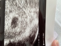 現在6w5d初妊娠です。写真は6w1dのものです。胎嚢のサイズ等な... - Yahoo!知恵袋