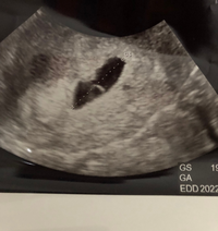 体外受精をして、現在6w5dのものです。 - 受診し、エコーをして... - Yahoo!知恵袋