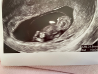 エコー写真の性別。10w1dのエコー写真です。まだまだわかる週数では無いんで... - Yahoo!知恵袋