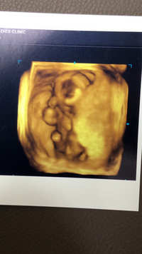 産科の超音波検査の件です。現在14w5dではじめてお腹の上から超音波検査をし... - Yahoo!知恵袋