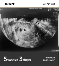 昨日5w3dで胎嚢が9ミリでした。双子らしいのですが先生は大きい方... - Yahoo!知恵袋