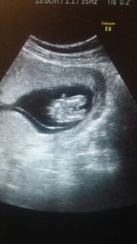 性別判定お願いします。13w4dで検診に行ってきました。股の間に何か... - Yahoo!知恵袋