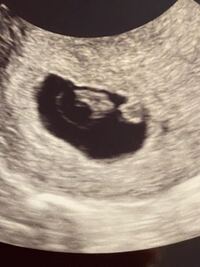 現在7w4dの妊婦です。 - 本日心拍確認のため産婦人科を受診しまし... - Yahoo!知恵袋